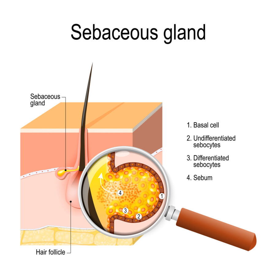 What are the bumps on my oily skin? - Enrich Clinic