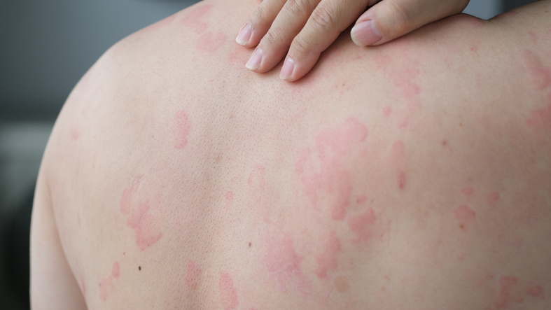 Top 10 Skin Conditions Dermatologists Treat